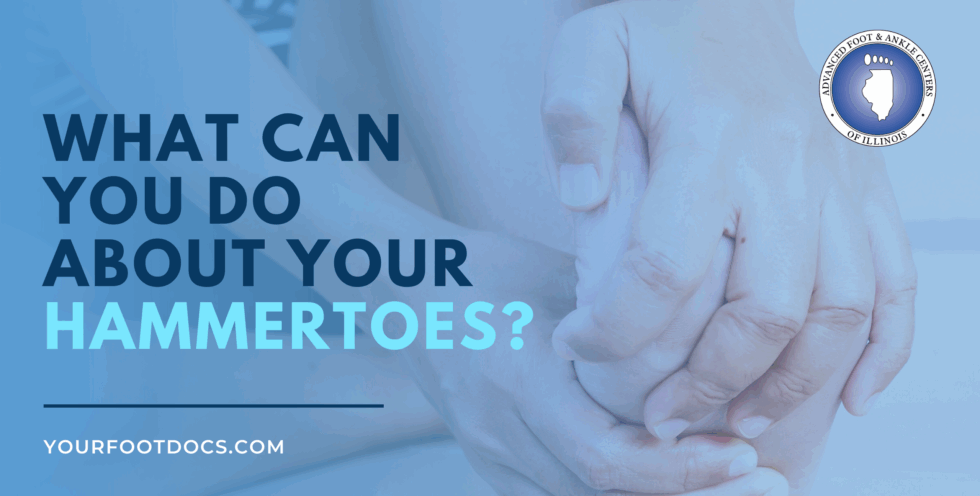 What Can You Do About Your Hammertoes? // Advanced Foot & Ankle Centers ...